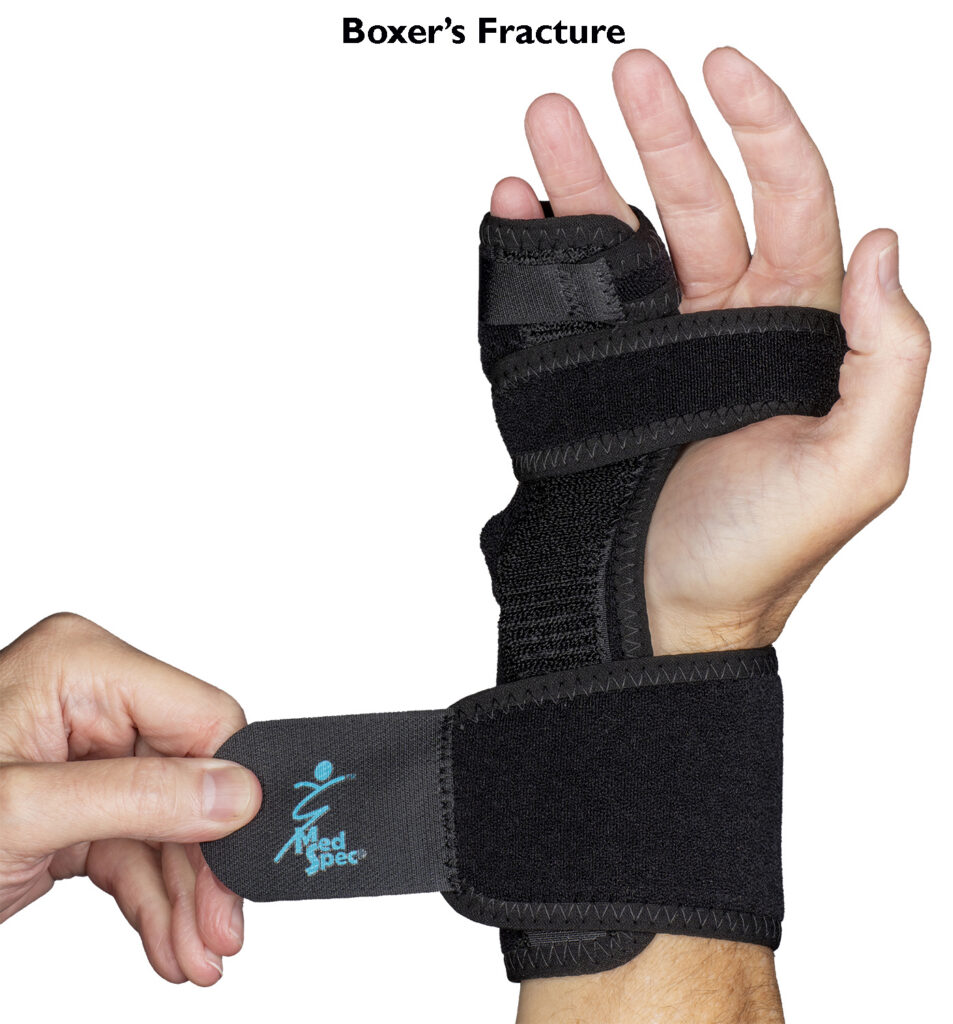 Boxer Splint II – Med Spec